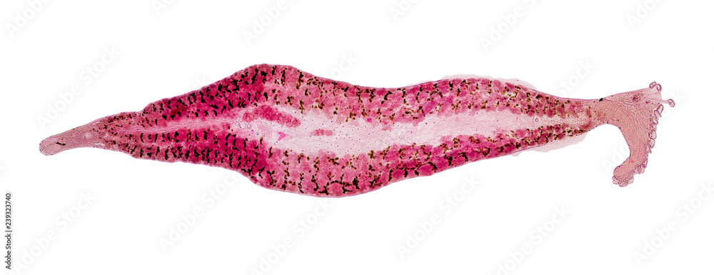 Patterns and backgrounds of Parasitic, Study for Anatomical pathology ...