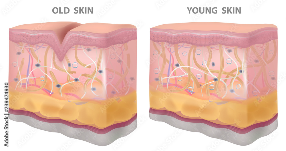 Skin young old wrinkles, realistic drawing,structure vector ...