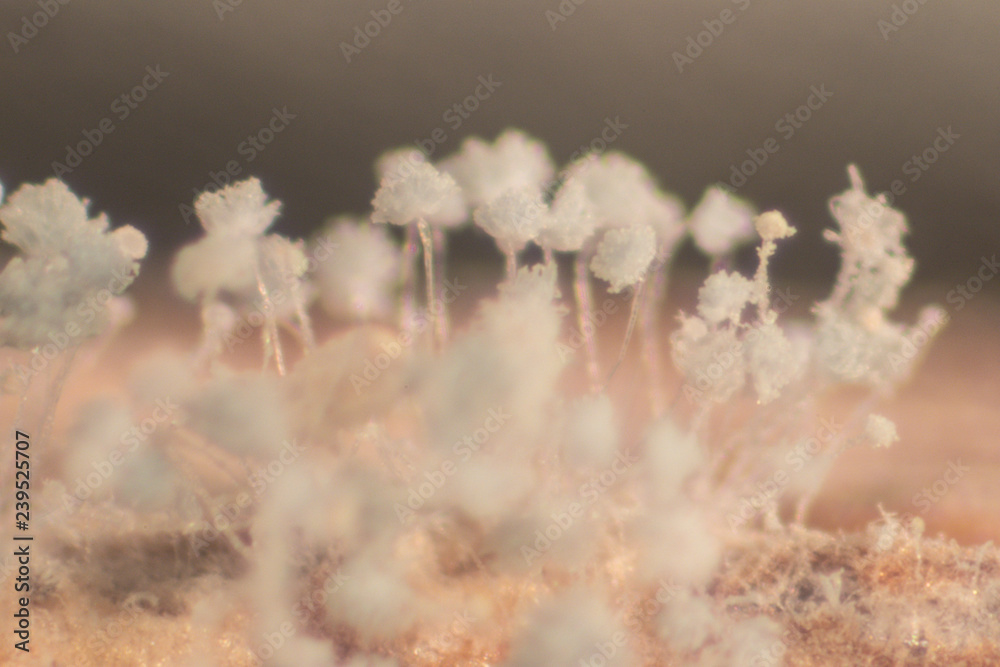 Rhizopus (bread mold) is a genus of common saprophytic fungi,Rhizopus ...