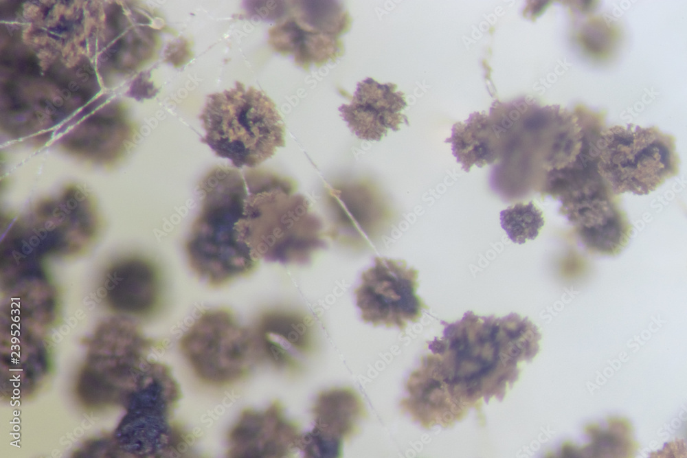 Rhizopus (bread mold) is a genus of common saprophytic fungi,Rhizopus ...