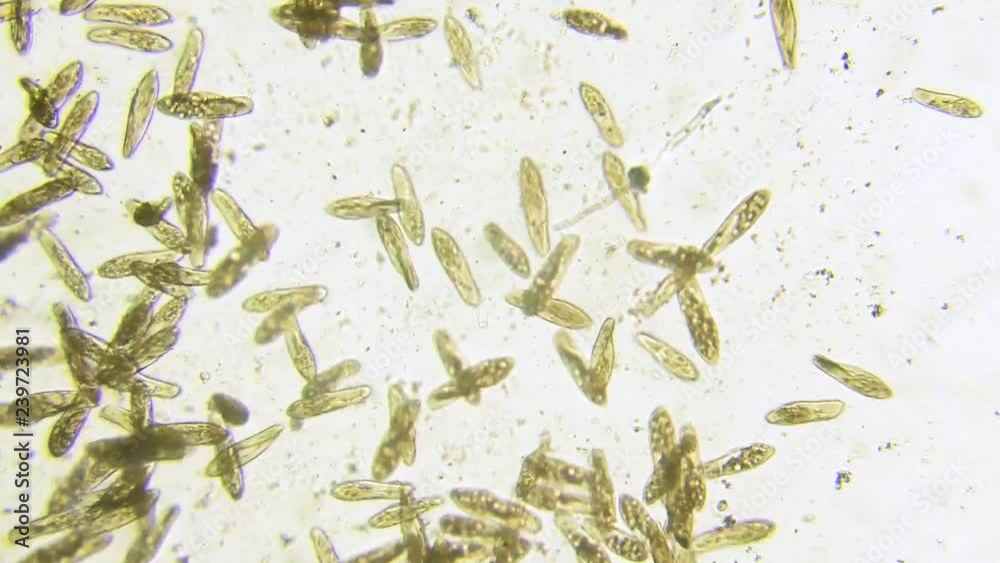 Microscope image footage of protozoa microorganisms in water, showing ...