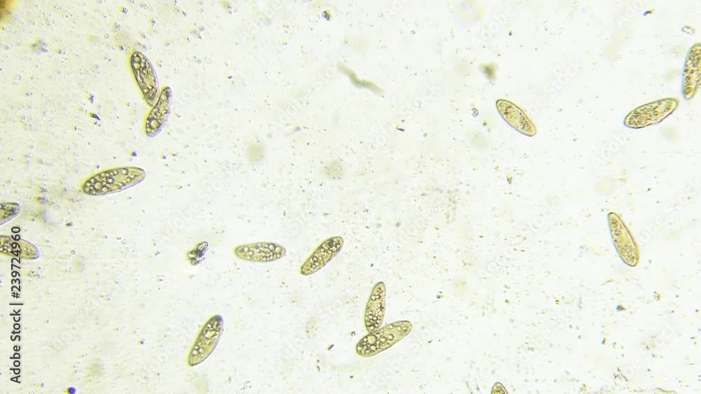 Microscope image footage of protozoa microorganisms in water, showing ...