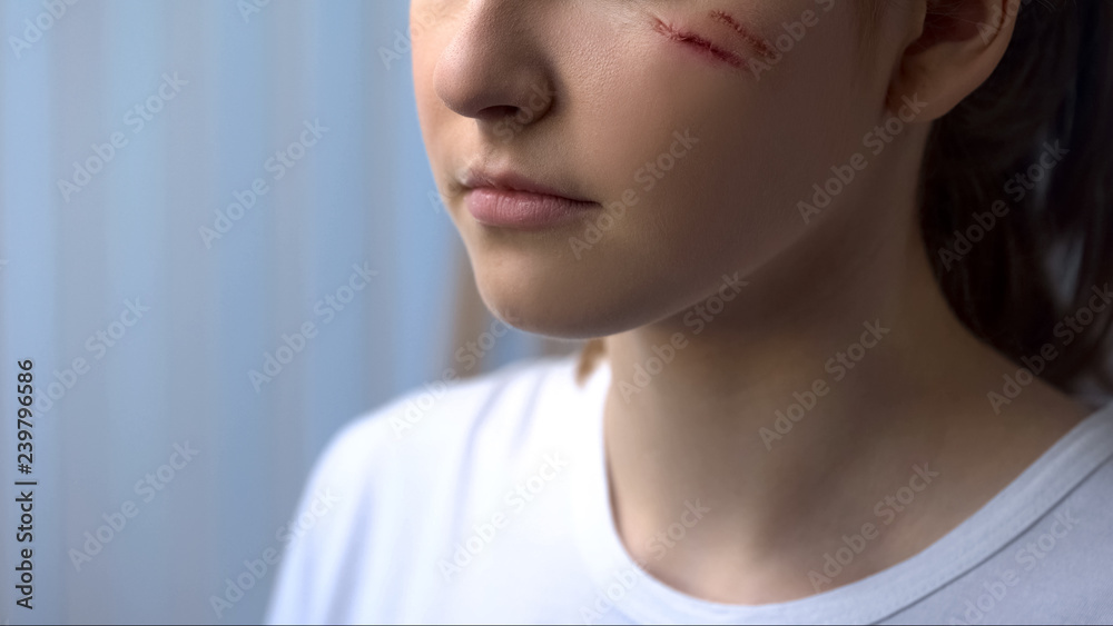 Physician handling wound on female face, scars and treatment after ...