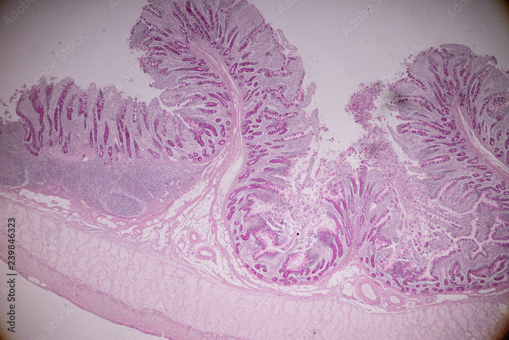 Tissue of small intestine or small bowel under the microscopic in Lab ...