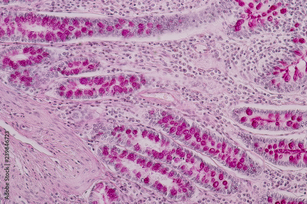Tissue of small intestine or small bowel under the microscopic in Lab ...