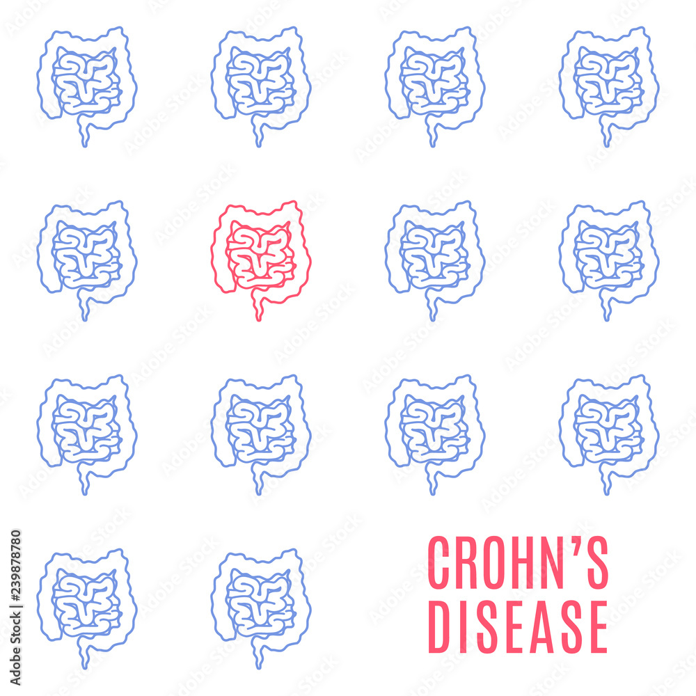 Crohns disease awareness poster. Medical pattern of healthy intestines ...