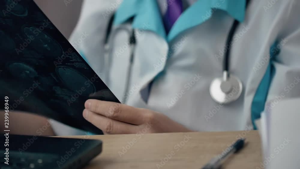 Doctor holding a picture of a brain MRI workflow in diagnostic hospital ...