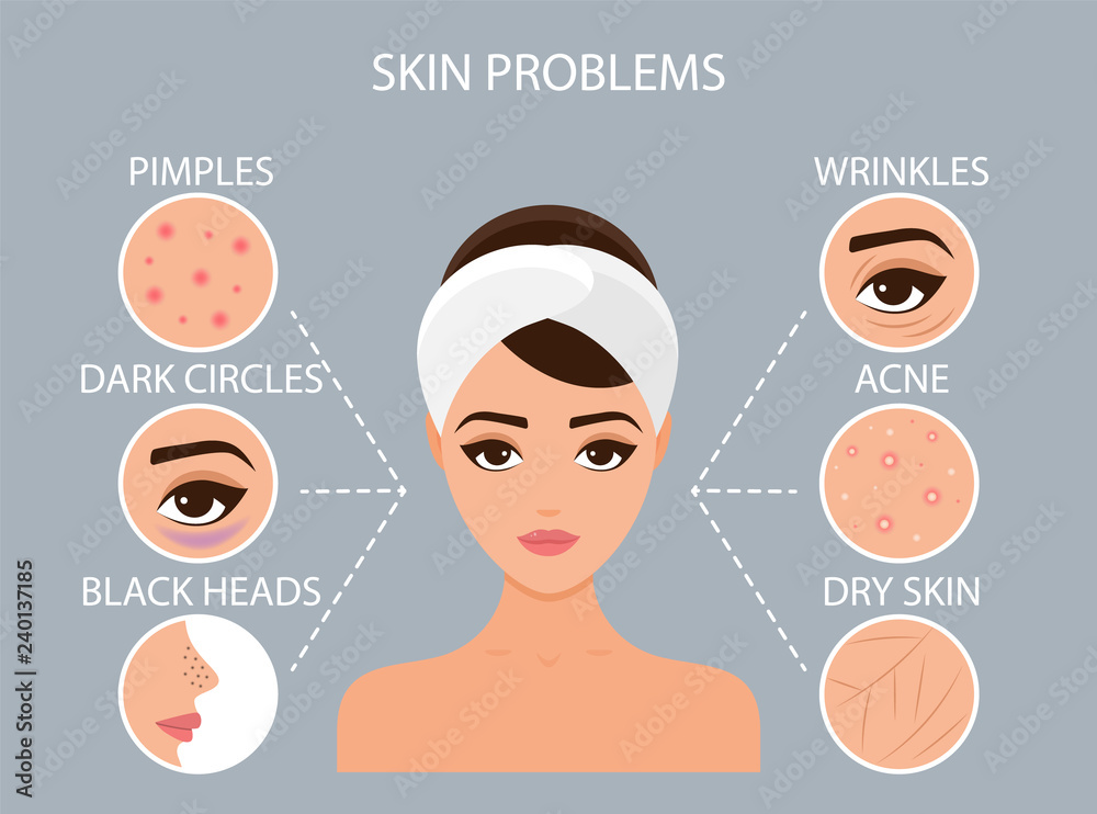 Skin problems, acne, wrinkles, pimples, dark circles, black heads, dry ...