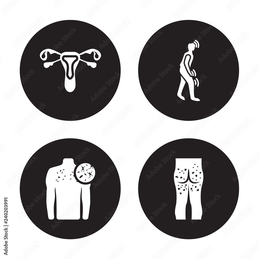 4 vector icon set : Non-gonococcal urethritis, Neoplasm, Night ...