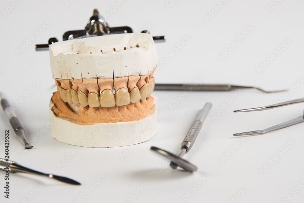 Clay mold human gums model in jaws prosthetic laboratory Stock Photo ...