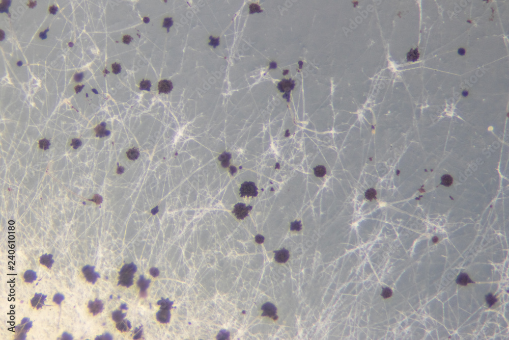 Bread Mold Under Microscope