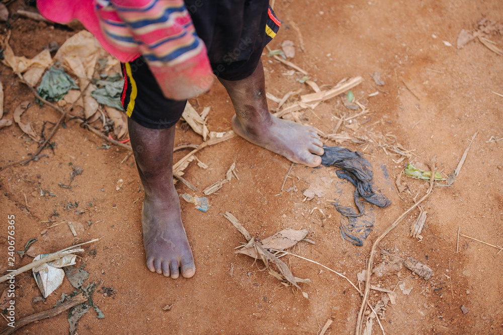 Bare feet of a young african boy Stock Photo | Adobe Stock