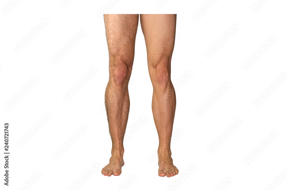 Caucasian legs of athletic man before and after shave on white ...