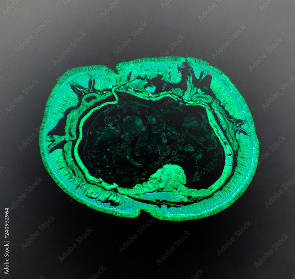Microscopy Magnified View Earthworm Cross Section Prepared Slide Stock