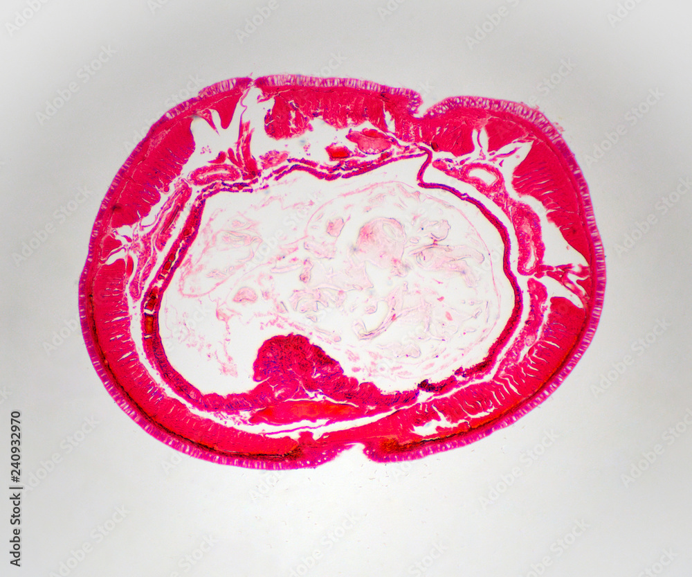 Microscopy Magnified View Earthworm Cross Section Prepared Slide Stock