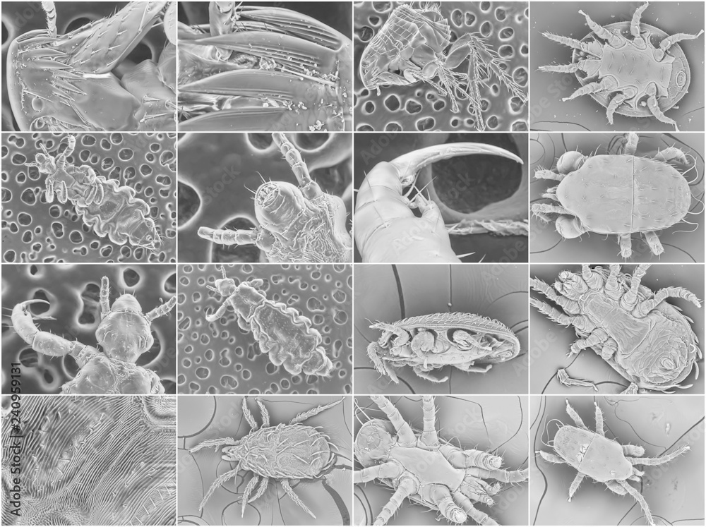 Insect electron microscope photos. Parasitic insects – ticks, fleas and ...