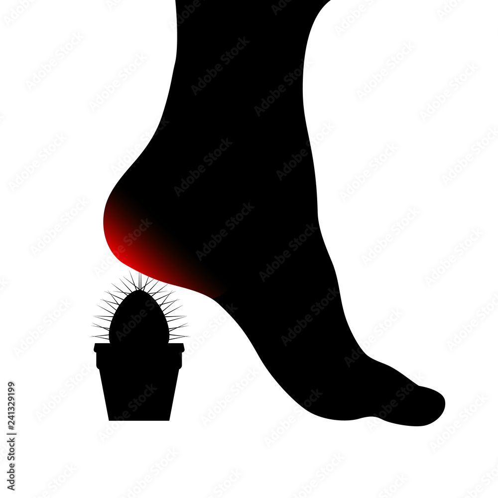 Symbol of Human foot with painful sore red heel. Cactus spines pierce ...