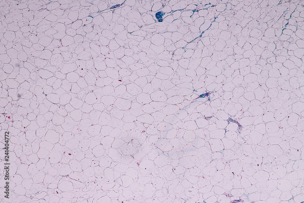 Adipose tissue/Body fat/Simply fat is a loose connective tissue under ...