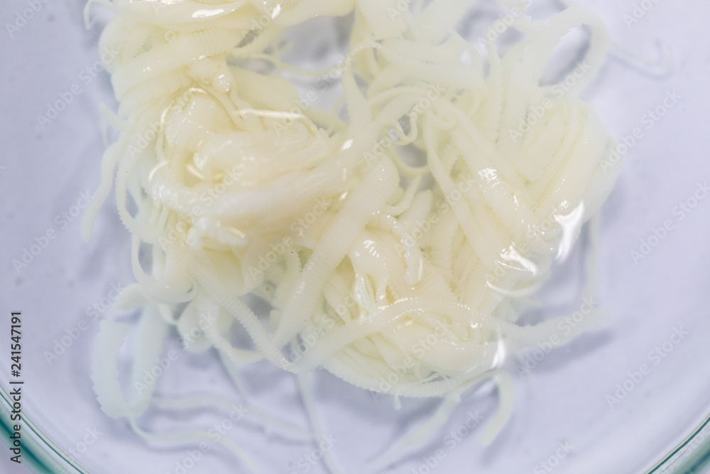 The study of Tapeworm infection is caused by ingesting food or water ...