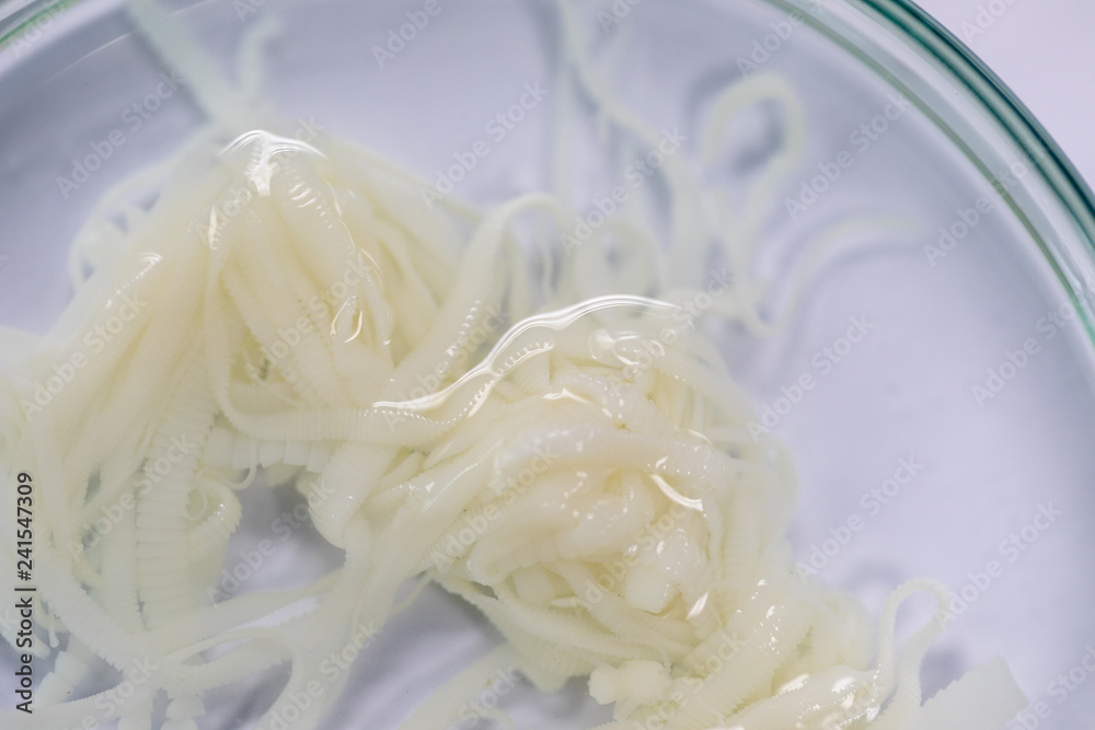 The study of Tapeworm infection is caused by ingesting food or water ...