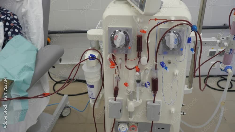 Hemodialysis. Machine artificial kidney. The hand of the patient is ...