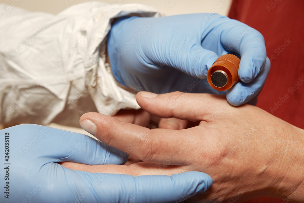 Proccess of collecting possible gunshot residue from suspected man ...