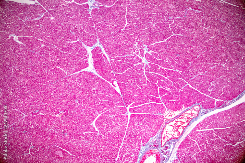 Tissue of pancreas is an organ of the digestive system and endocrine ...