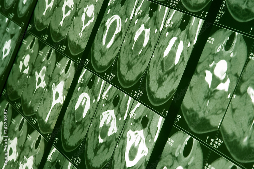 Cat Scan - X-ray Images of Neck Stock Photo | Adobe Stock