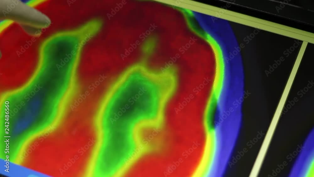 Analyzing of Brain Image on Touch Screen Display. Doctor and MRI Scan ...