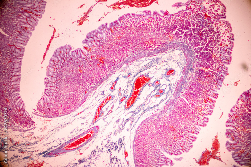 Tissue of Stomach under the microscopic, Physiology of the stomach for ...
