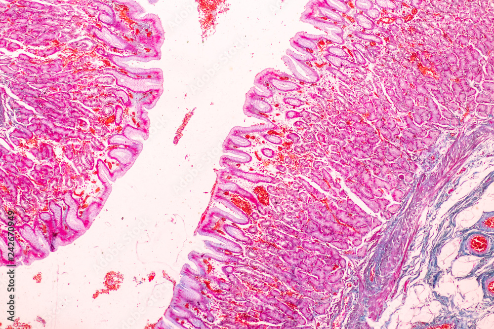 Tissue of Stomach under the microscopic, Physiology of the stomach for ...