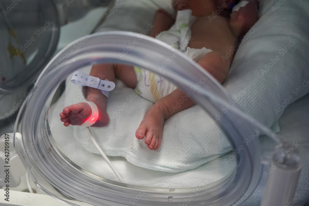 New born baby at the hospital in neonatal care Stock Photo | Adobe Stock