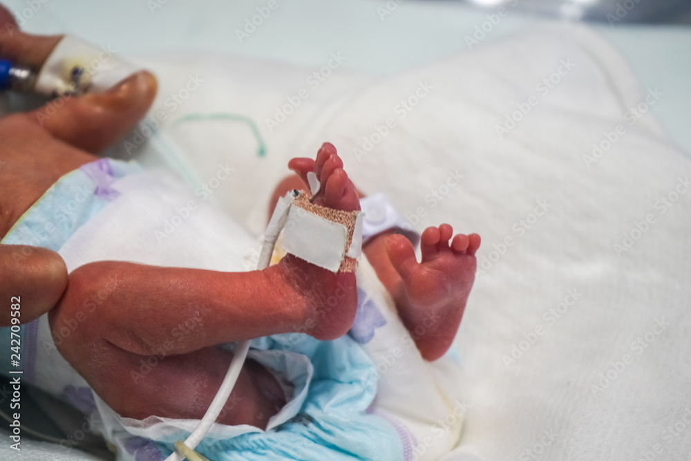 New born baby at the hospital in neonatal care Stock Photo | Adobe Stock