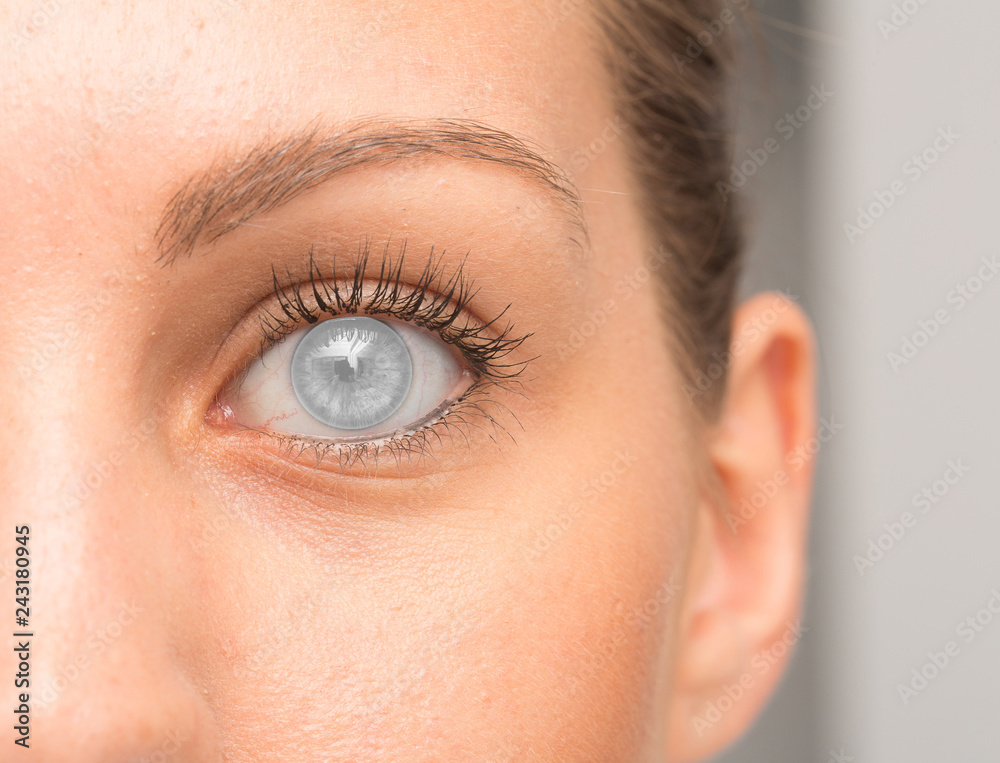 Rapresentation of eye with corneal opacity Stock Photo | Adobe Stock