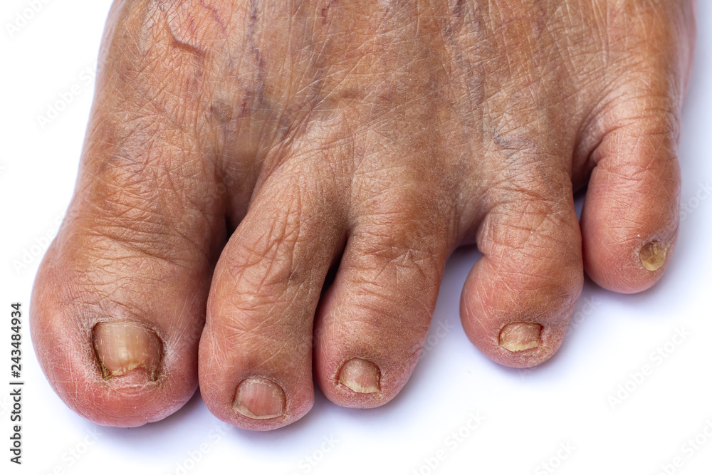 African American Toes