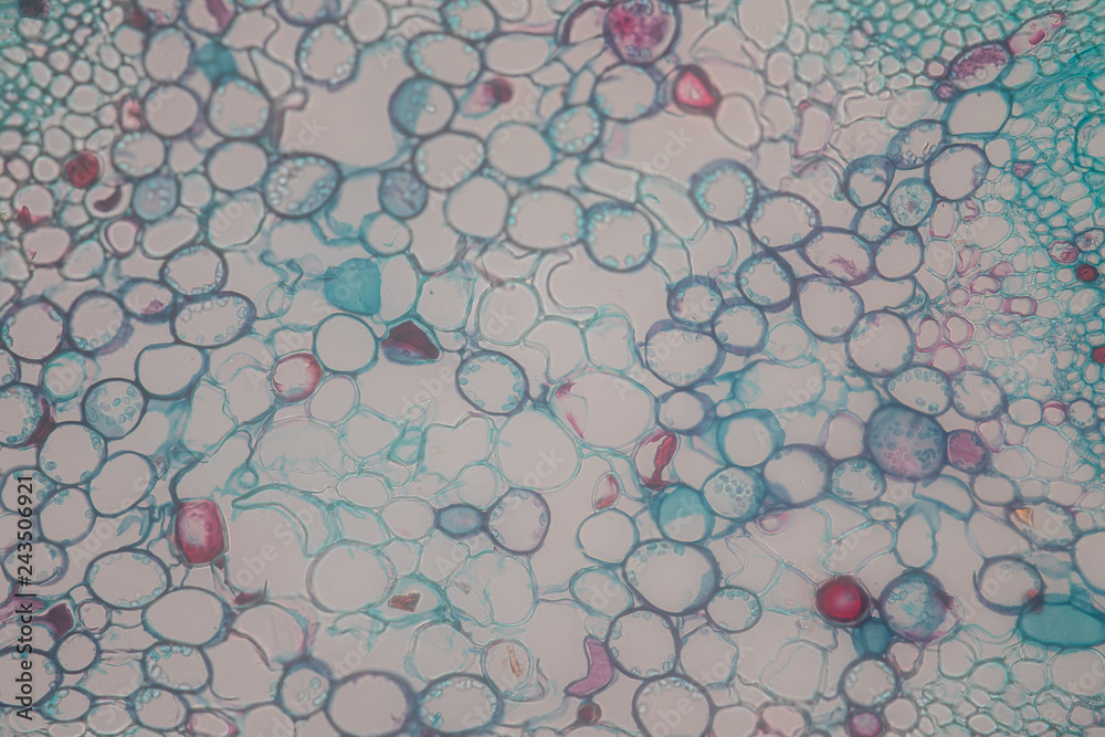 Cross-section Dicot, Monocot and Root of Plant Stem under the ...