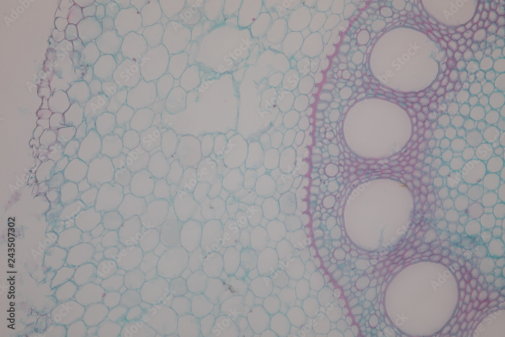 Cross-section Dicot, Monocot and Root of Plant Stem under the ...