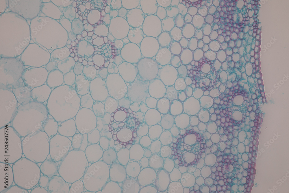 Cross-section Dicot, Monocot and Root of Plant Stem under the ...