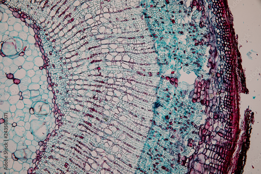 Cross-section Dicot, Monocot and Root of Plant Stem under the ...