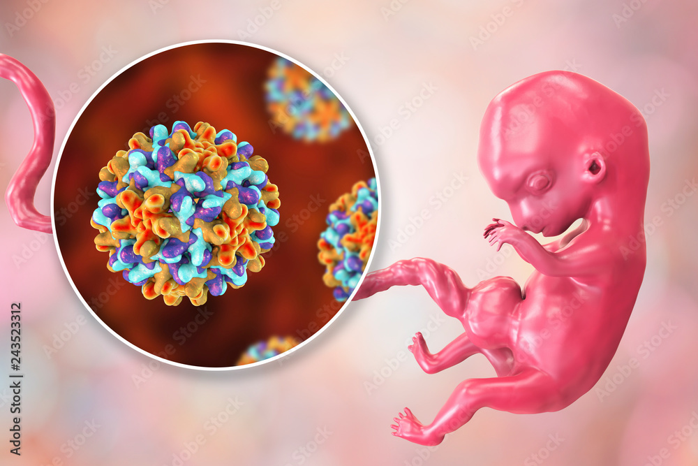 Transplacental transmission of Hepatitis B viruses to human embryo, 3D ...