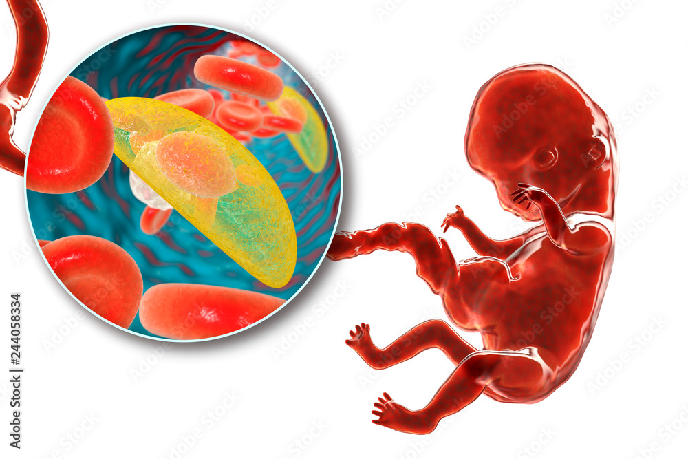 Transplacental transmission of Toxoplasma gondii parasites to human ...
