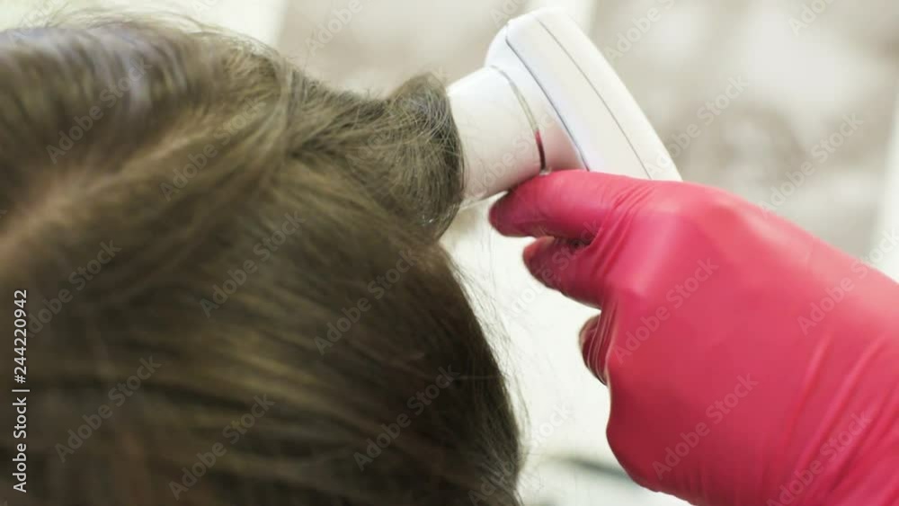 doctor dermatologist diagnoses the structure of the hair of a young ...