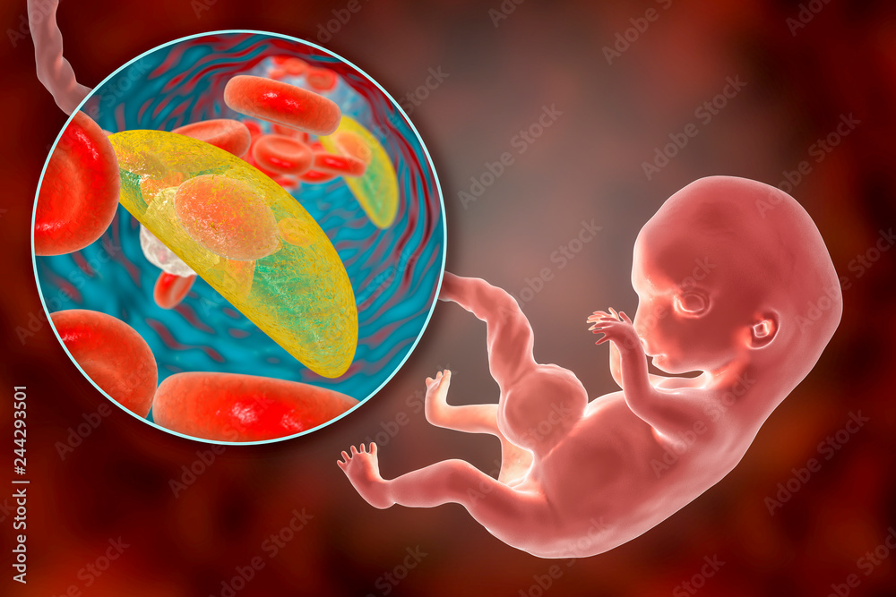 Transplacental transmission of Toxoplasma gondii parasites to human ...