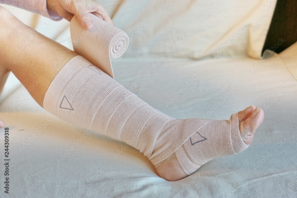 Bande de contention Stock Photo | Adobe Stock