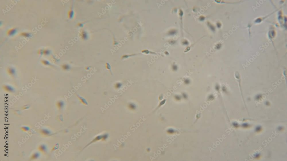 Sperm Spermatozoa Viewed Under The Microscope Moving Human Sperm