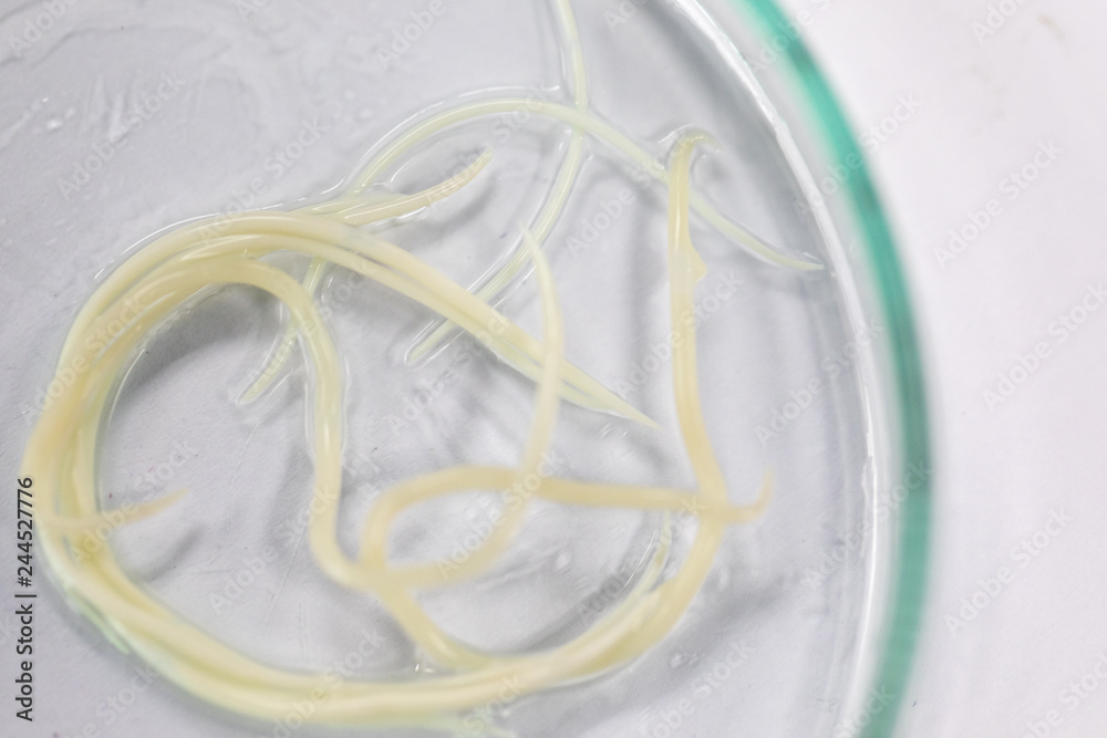 Ascariasis is a disease caused by the parasitic roundworm Ascaris ...