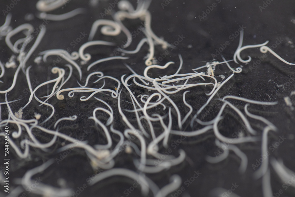 Ascariasis is a disease caused by the parasitic roundworm Ascaris ...