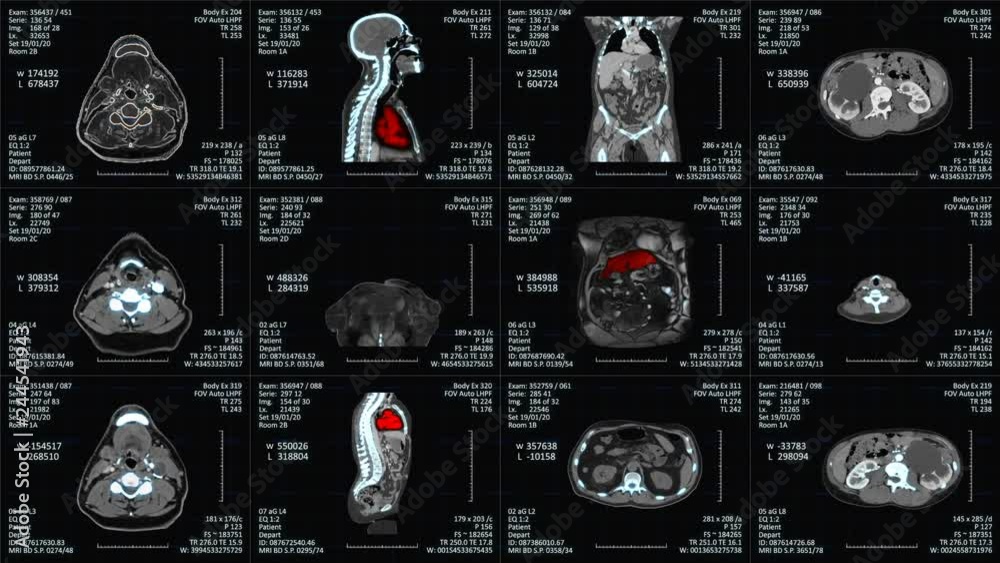 MRI Scan video wall screen. Medical monitor with multiple views of ...