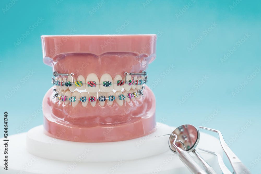 orthodontic model and dentist tool - demonstration teeth model of ...