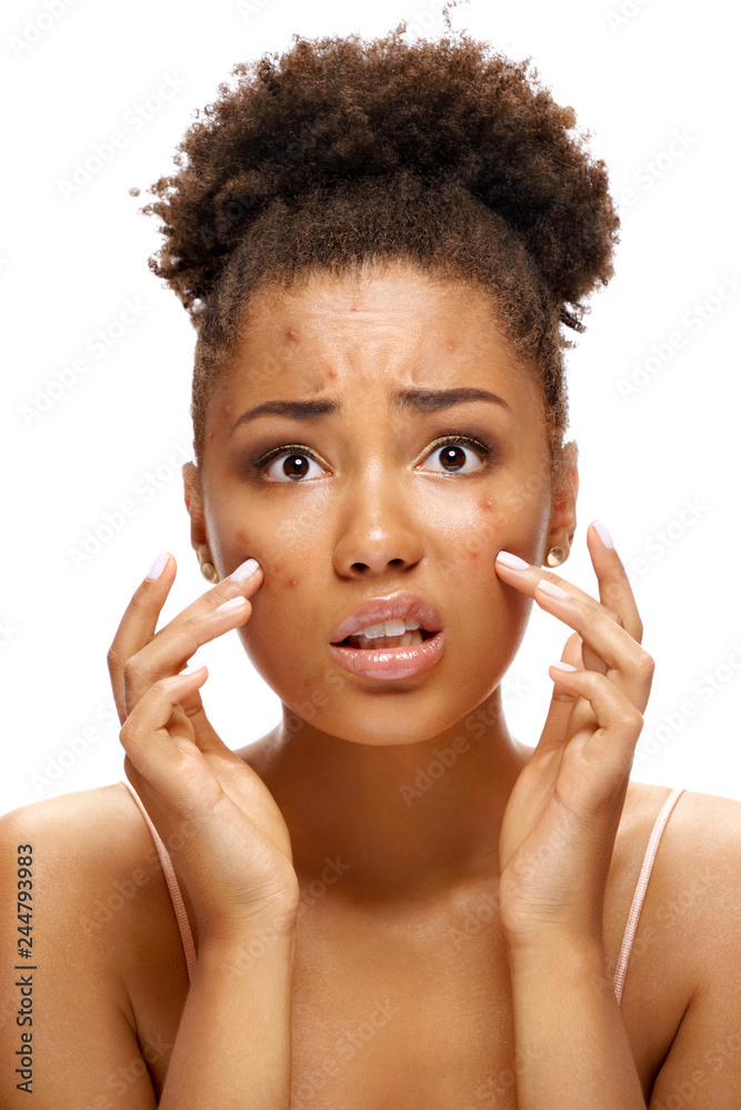 Young girl in shock of her acne. Photo of african american girl with ...